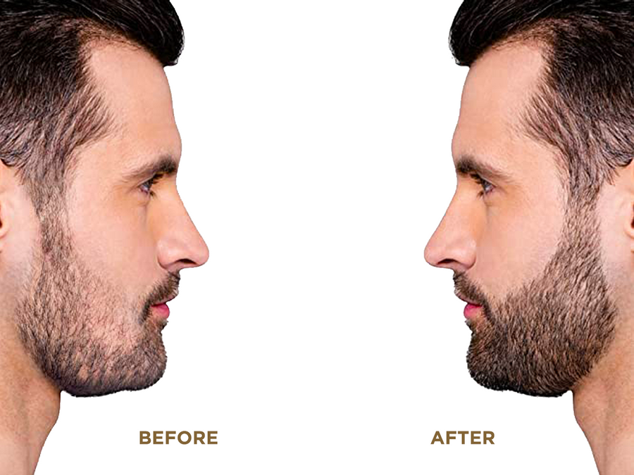 Luxury Beard Dye | Enhance Your Appearance | Beard Dye Inc